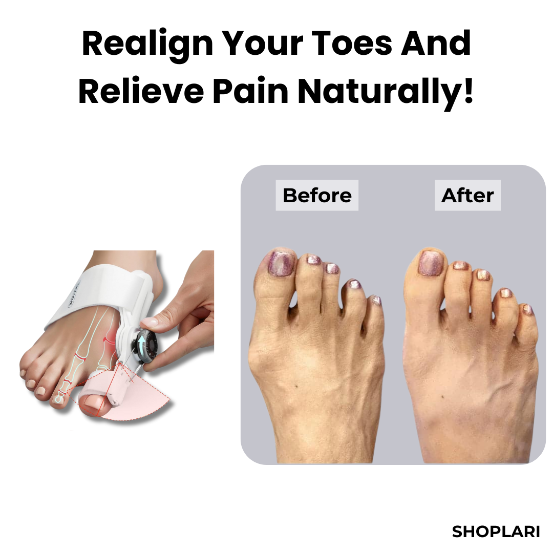 StrideEase™ — Walk Pain-Free with Gentle Toe Realignment You’ll Love W ...